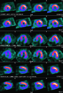 St. George - Sutherland Nuclear Medicine