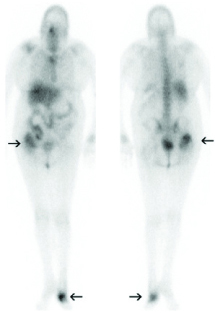 St. George - Sutherland Nuclear Medicine